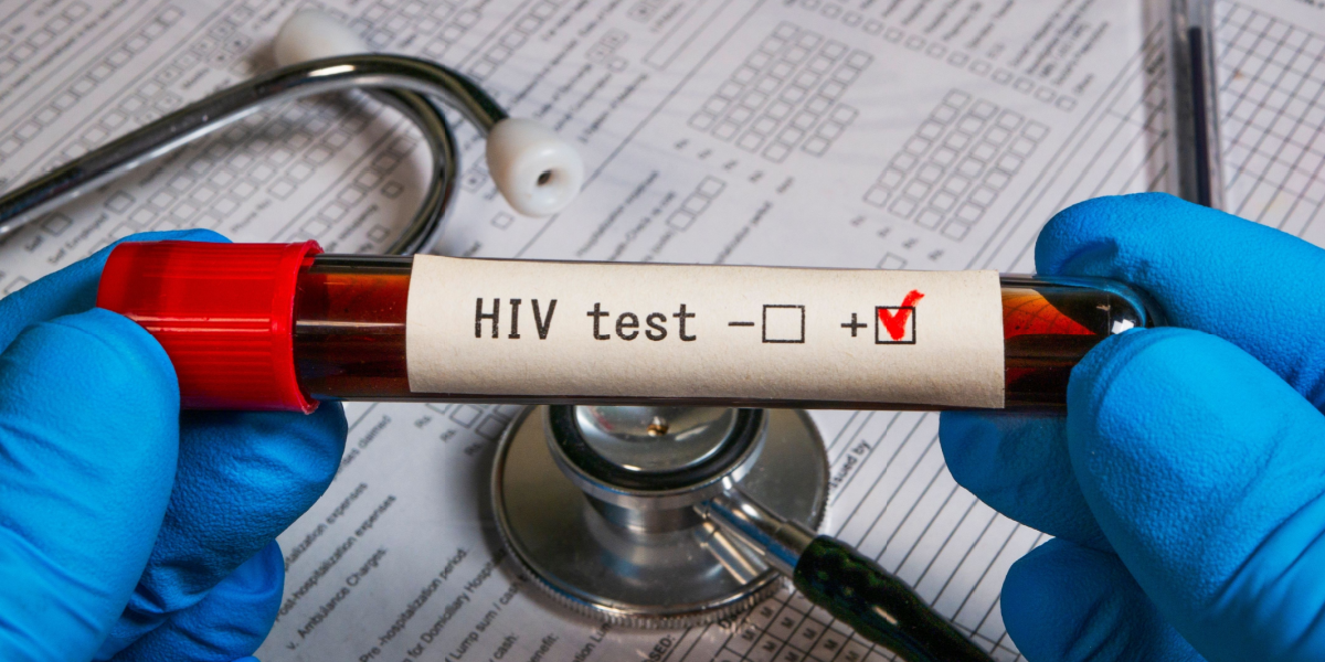 HIV-Infektionen in der russischen Armee seit Beginn des Ukraine-Kriegs ...